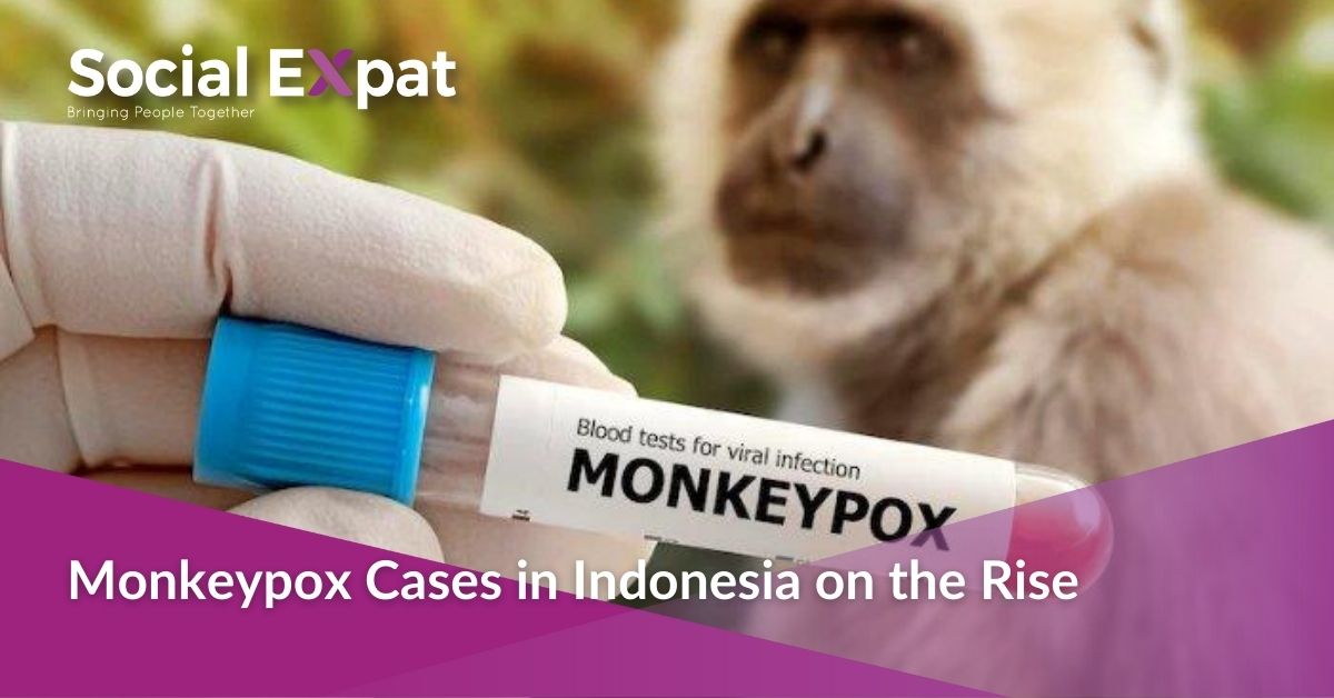 Monkeypox Cases in Indonesia on the Rise | Social Expat